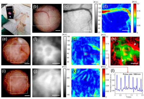 Biosensors Special Issue Smartphone Based Sensors For Biomedical