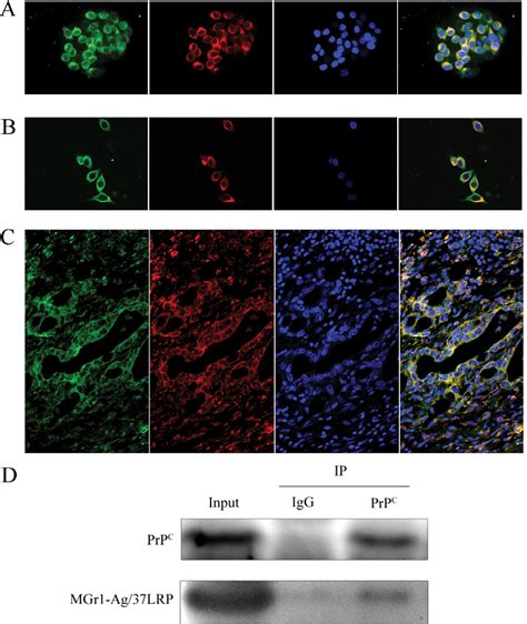 Figure 2 From Mgr1 Antigen37 Kda Laminin Receptor Precursor Promotes