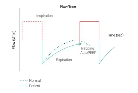 Measurement Of Autopeep And Total Peep Hamilton Medical