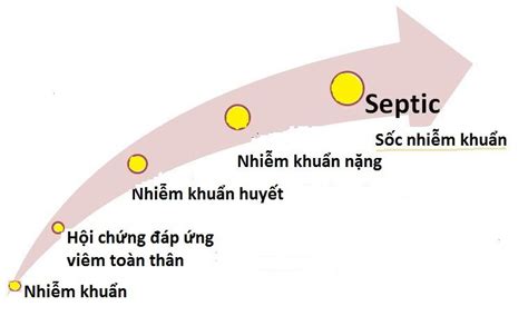 Chẩn đoán Sốc Nhiễm Khuẩn Vinmec