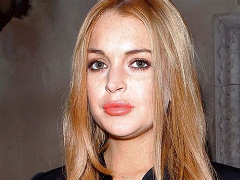 Celebrities Del Amor Al Odio Por El Botox Infobae
