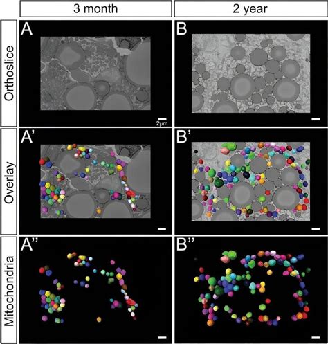 Researchers Map Structure Of Mitochondria At Different Life Stages Lifeboat News The Blog