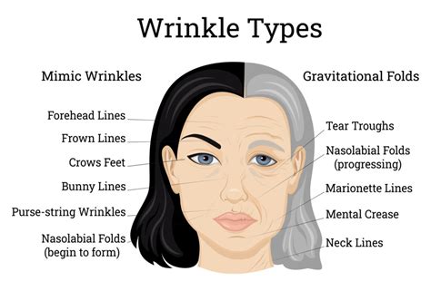 Types Of Wrinkles In The Face Wrinklefreetips Com