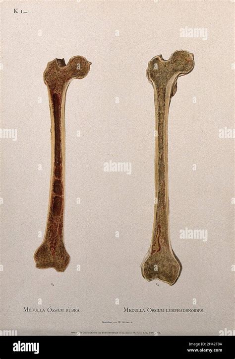 Sections Through Two Femur Bones The Left Illustration Indicating The