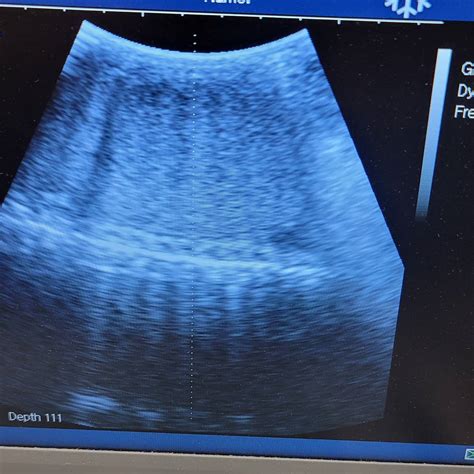 Python Spawn Python Spawn Added A New Photo