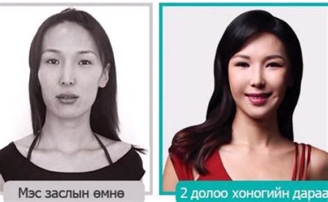 Мисс Э Сэлэнгэ гоо сайхны хагалгаанд орсон мөнгөө ингэж олов