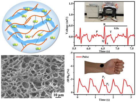 Healable Degradable And Conductive Mxene Nanocomposite Hydrogel For Multifunctional Epidermal