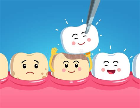 Gum Disease Cartoon Stock Illustrations 720 Gum Disease Cartoon Stock