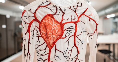 Eline Van Der Velde Posted On Linkedin