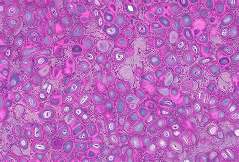 Ear Cartilage Histology