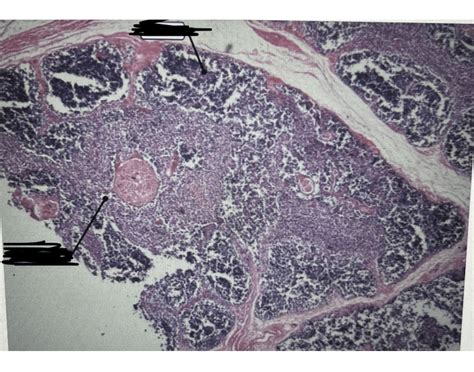 Histology Fetal Thymus Quiz