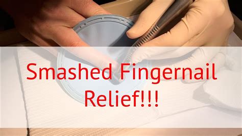 Smashed Fingernail