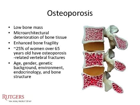 Lecture 49 Bone Physiology Resorption And Formation Pat