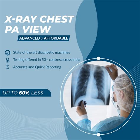 X Ray Chest Pa View Aarthi Scans And Labs