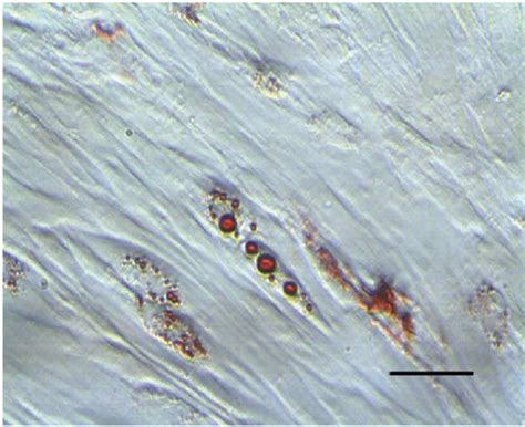 Growth Of DP MSCs From Explants And Their Differentiation A DP MSCs