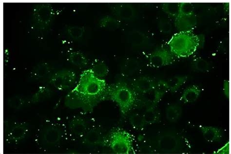 Immunofluorescence Assay Testing Service Creative Diagnostics