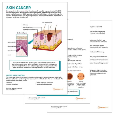 Skin Cancer Patient Education Handout Printable Pdf Anatomystuff