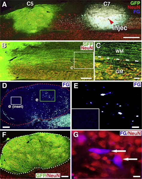 Retrograde Labeling Of Caudally Projecting Neurons In Rat Npc Grafts Download Scientific