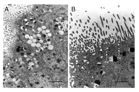 Ultrastructure Of The Inverted Yolk Sac Placenta Of The Paca A The Download Scientific