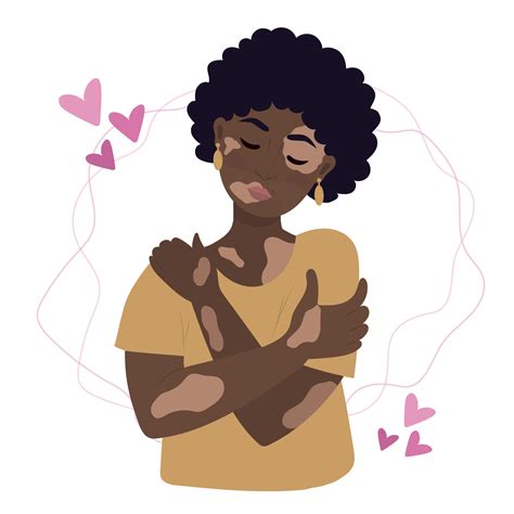 Love Yourself Concept Woman With Albinism Hugging Herself