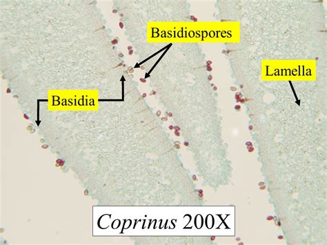 Coprinus 400x