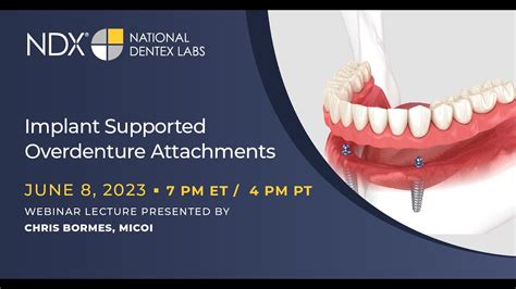 Implant Supported Overdenture Attachments Youtube