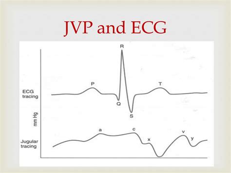 Ppt Jugular Venous Pulse And Carotid Arterial Pulse Powerpoint