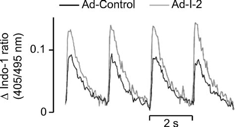 Ca²⁺ Transients In Spontaneously Beating Neonatal Rat Cardiomyocytes