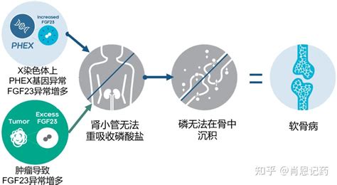 记住治疗低磷血症生物药 麟平布罗索尤单抗 成纤维细胞生长因子23FGF23拮抗剂 知乎