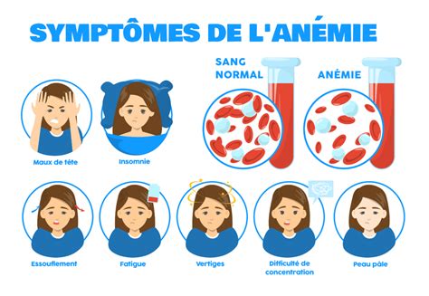 Anémie Causes Symptômes et Traitements Information hospitalière