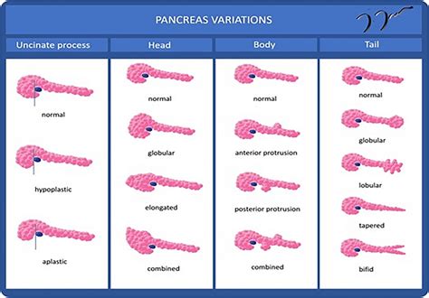 These Schematic Drawings Clearly Demonstrate The Development Of The Download Scientific Diagram