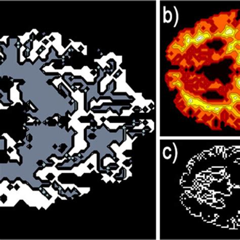An Image Slice Of The Mri Data From A Healthy Individual At Various Download Scientific