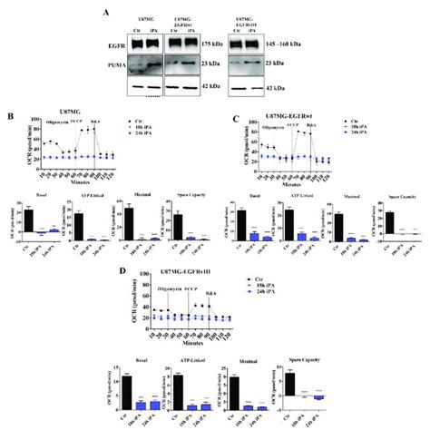 Ipa Impaired Mitochondrial Metabolism In Gbm Stabilized Cell Lines A
