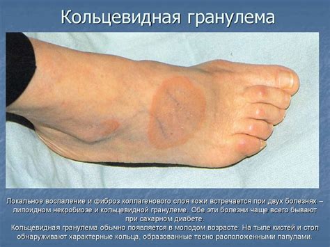 Дифференциальная диагностика высыпаний на лице презентация онлайн