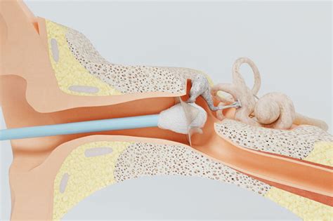 Three Reasons Why You Should Stop Using Cotton Swabs World Wise News