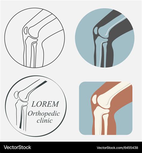 Human Knee Joint Royalty Free Vector Image Vectorstock