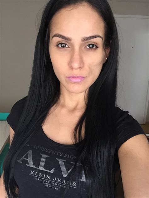Ego Vítima De Síndrome Rara Dai Macedo Faz Cirurgia De Preenchimento
