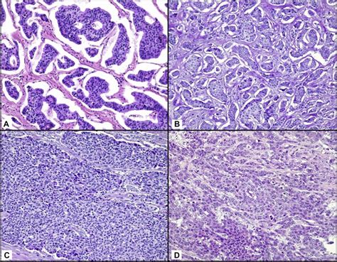 Histologically Well Differentiated Net G1 Displays A Download