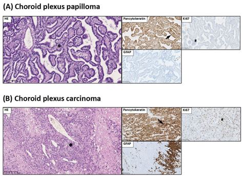 Choroid Plexus Histology