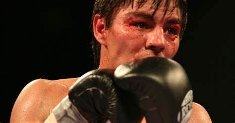 La Vez Que El Travieso Arce Peleó Noqueado Todo Un Combate “no Supe De