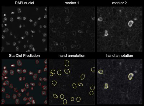 using stardist as a start for further classification image analysis image sc forum