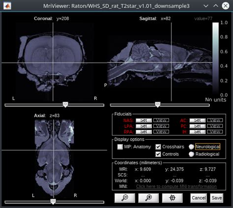 Mri Viewer Offset · Issue 263 · Brainstorm Toolsbrainstorm3 · Github