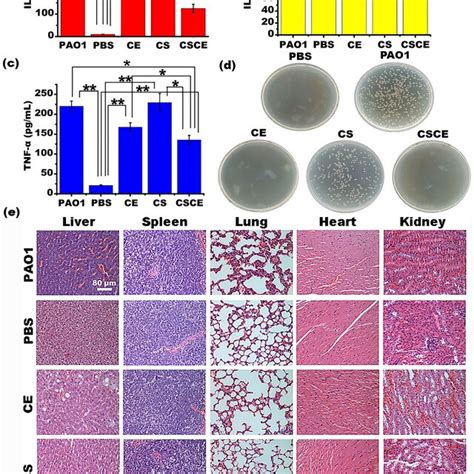 Il 6 A Il 17 B Tnf α C In The Mice Lungs Through Elisa D The