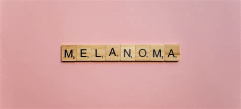 Can You Tell Melanoma Facts From Myths Upmc Italy