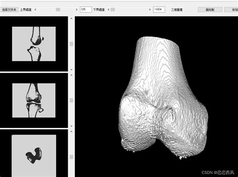 三维重建 阈值分割 3d可视化 医学图像分割 Ct图像分割及重建系统 可视化编程技术及应用3d医学图像阈值处理 Csdn博客