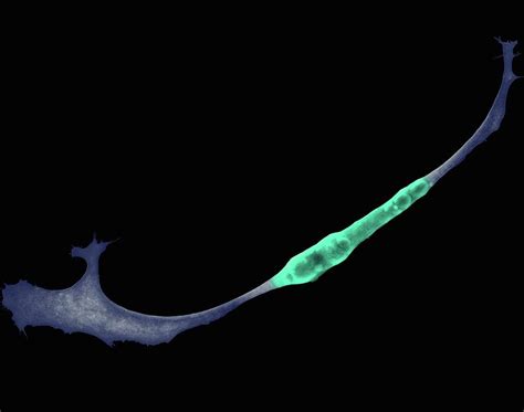 Skeletal Muscle Cell In Culture Photograph By Dennis Kunkel Microscopy
