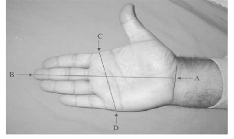 Hand Of Human Being Demonstrates The Landmarks Hand Length Ab And