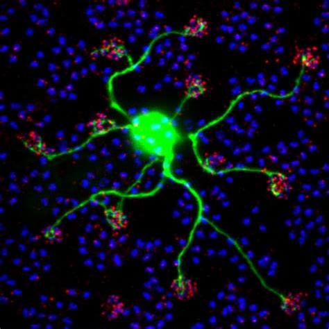 Image Bipolar Cells Receiving Inputs From Cones Science Eyewire Forum
