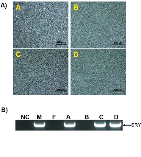 Separation And Sex Determination Of Pef Cells A Pef Cells Were Download Scientific Diagram Separation And Sex Determination Of Pef Cells A Pef Cells Were Download Scientific Diagram