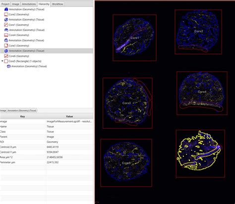 QuPath Resolve Hierarchy Geometry Annotation Type Image Analysis